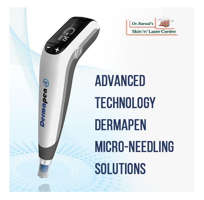 Dermapen Micro-Needling Solutions | Microneedling treatment in Chandigarh